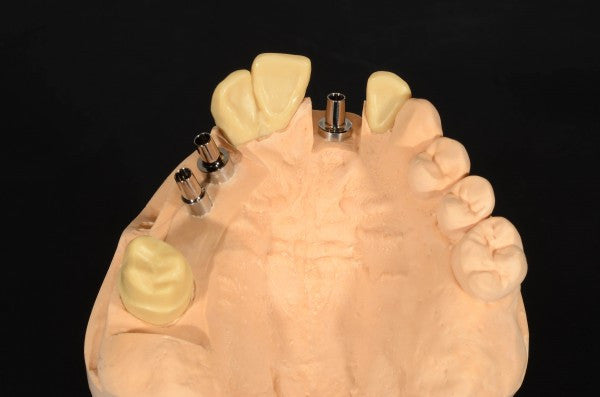 Luka Clear – Indenco Dental Products